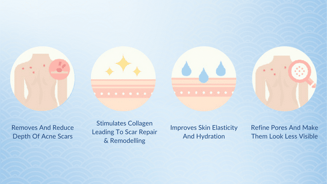 Bacne Treatment: Back Acne + LED Light Therapy - Ikeda Spa Singapore